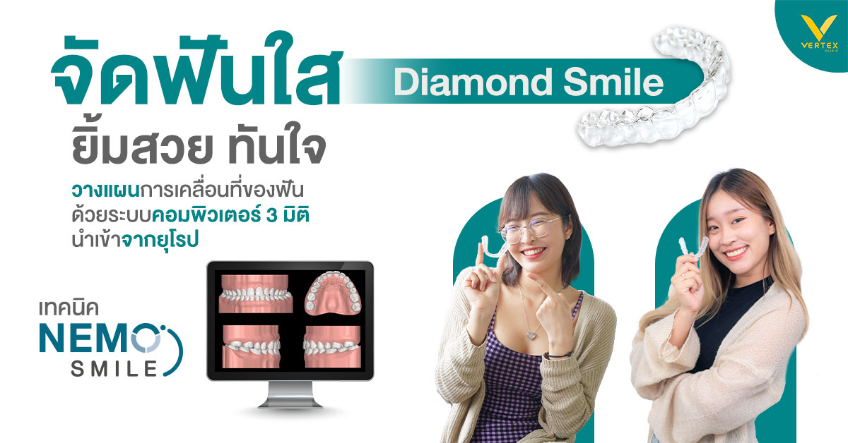 จัดฟันแบบใส Diamond Smile ฟันเรียงสวยทั้งปาก ยิ้มได้อย่างมั่นใจไร้เหล็ก